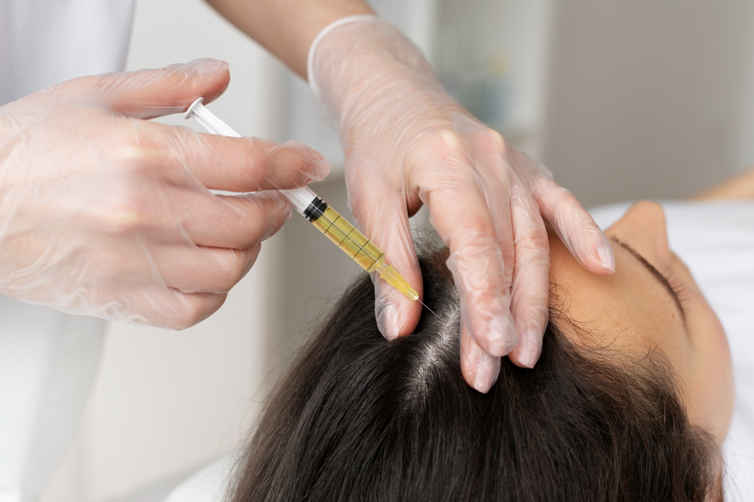 How to Determine the Type of Scalp You Have - HairStuff